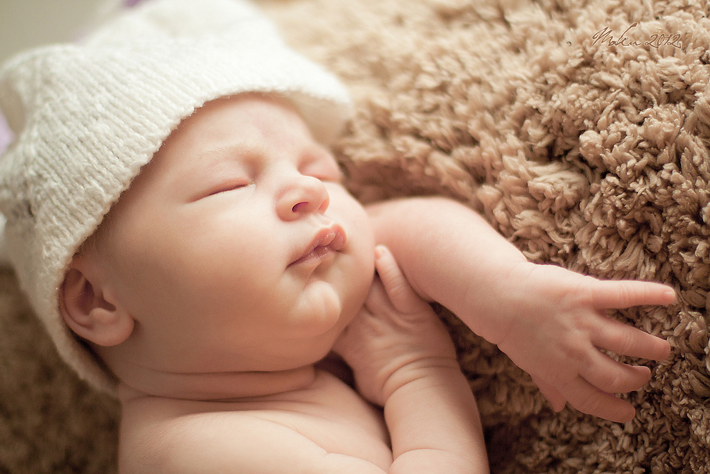 Žutica novorođenčeta - Portal Moj pedijatar