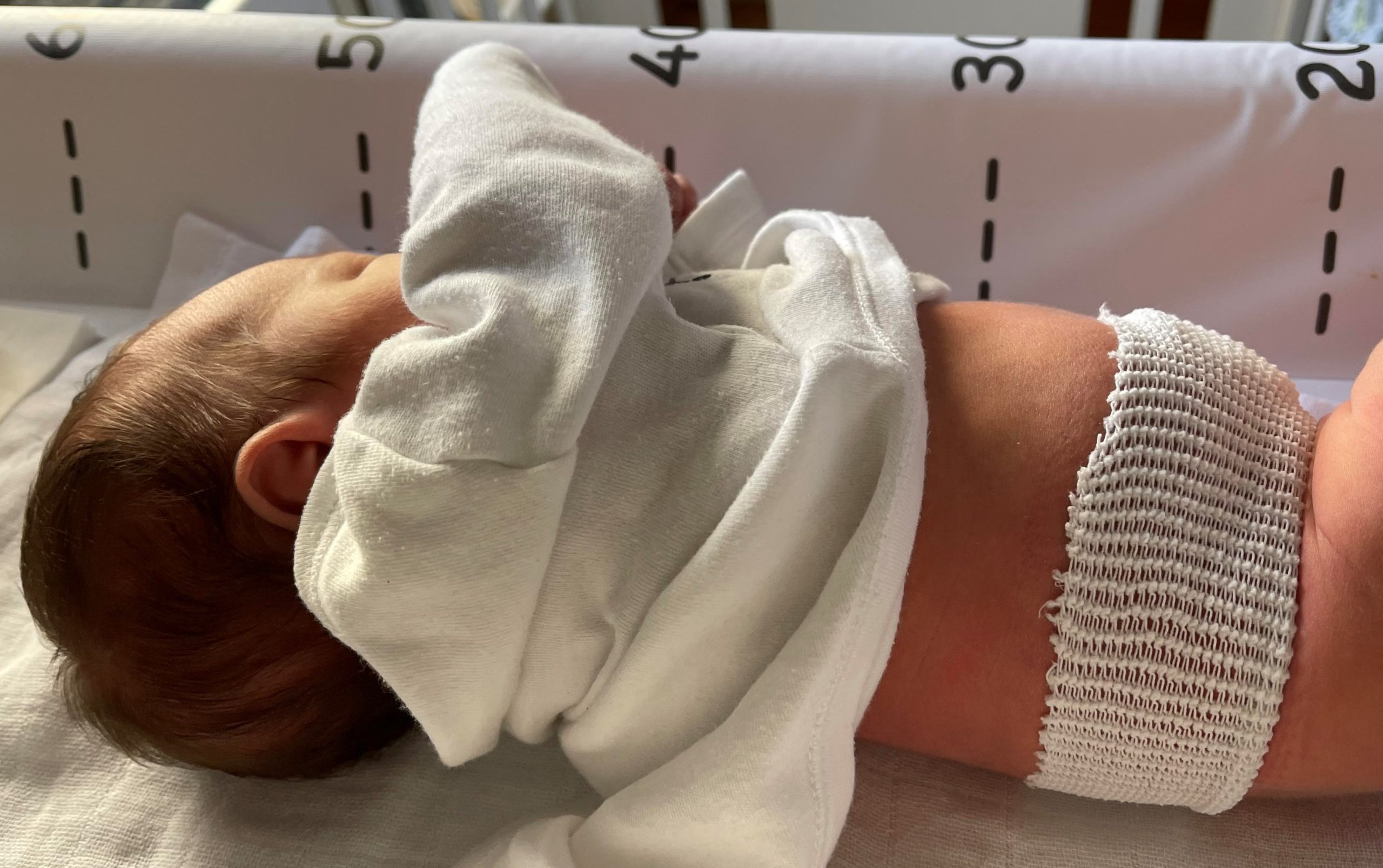 Nega pupka kod novorođene bebe (video) - Portal Moj pedijatar