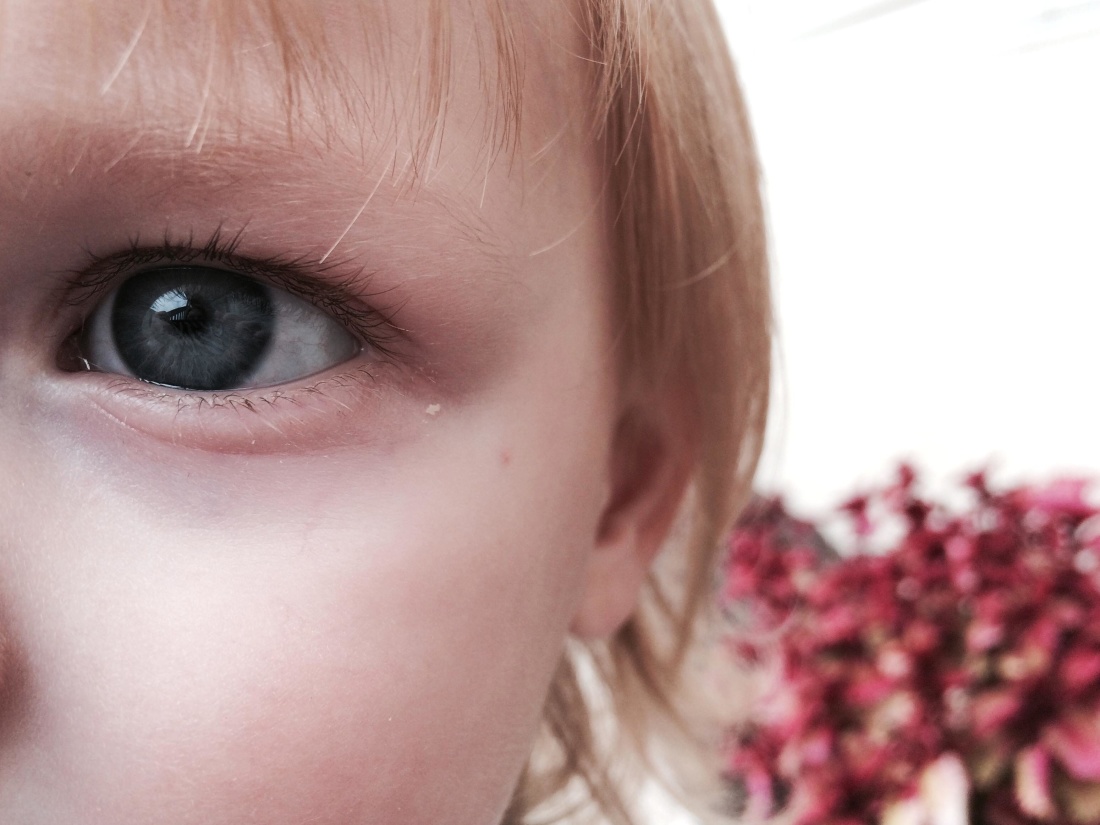 Kako se leči strabizam kod dece? - Portal Moj pedijatar